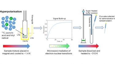 Hyperpolarisation | Medicine and Population Health | The University of ...