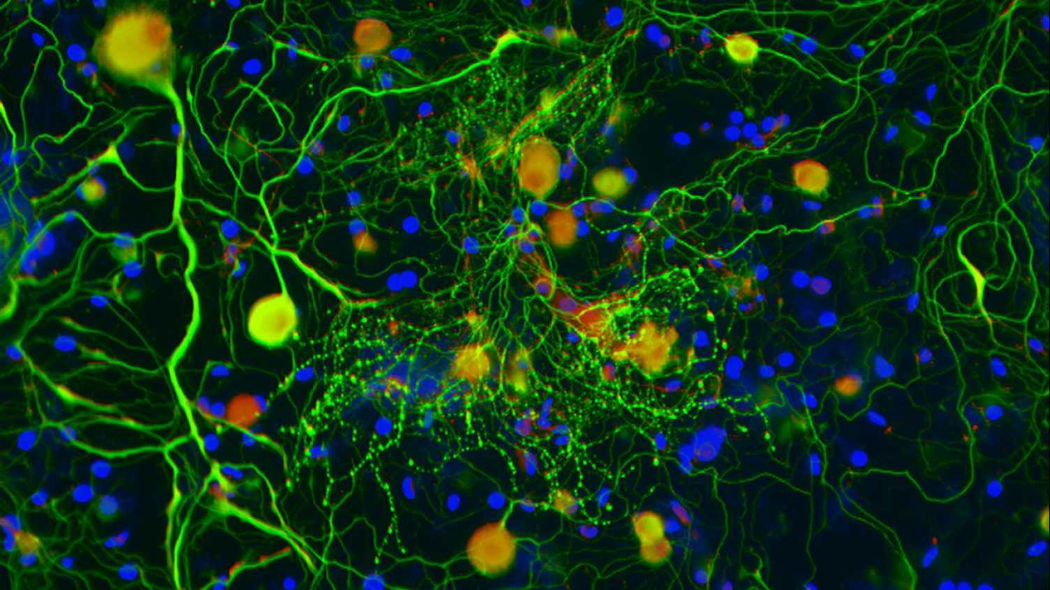 Pain network and people | Neuroscience Institute | The University of ...