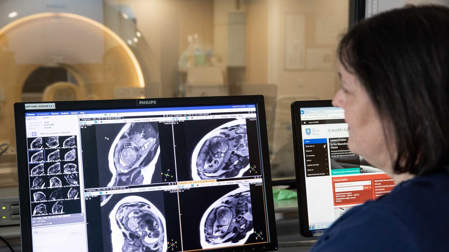 Planning a New MRI Study | Medicine and Population Health | The ...