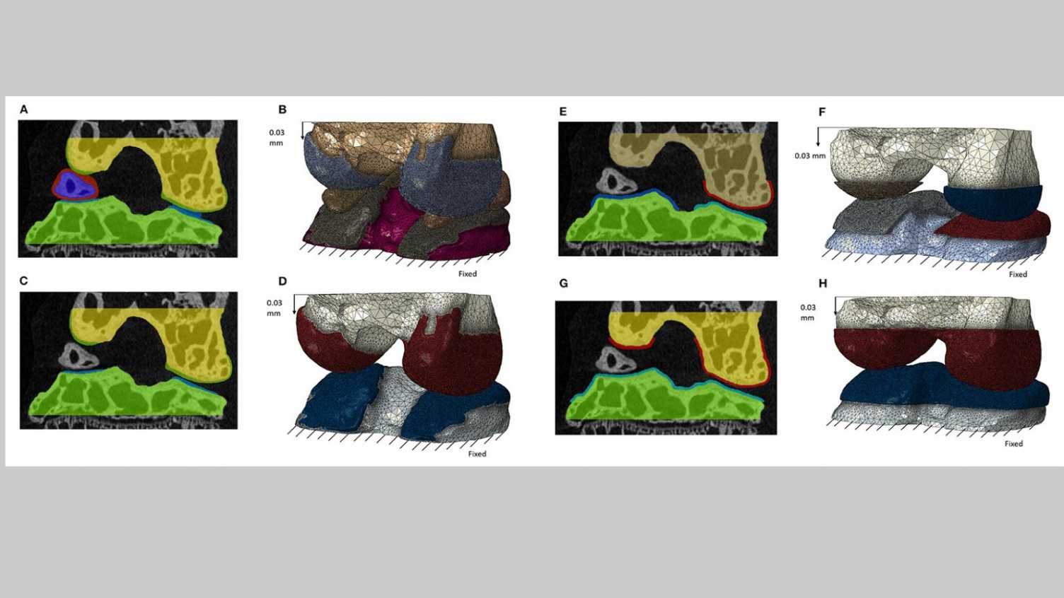 Development of subject specific finite element models of the mouse knee ...