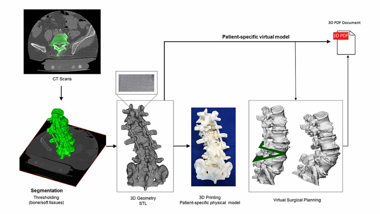 Complicated postoperative flat back deformity correction | Spinner-EID ...